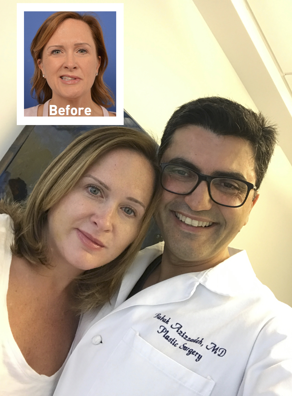 Selective Neurolysis for Synkinesis and Facial Paralysis Selective ...